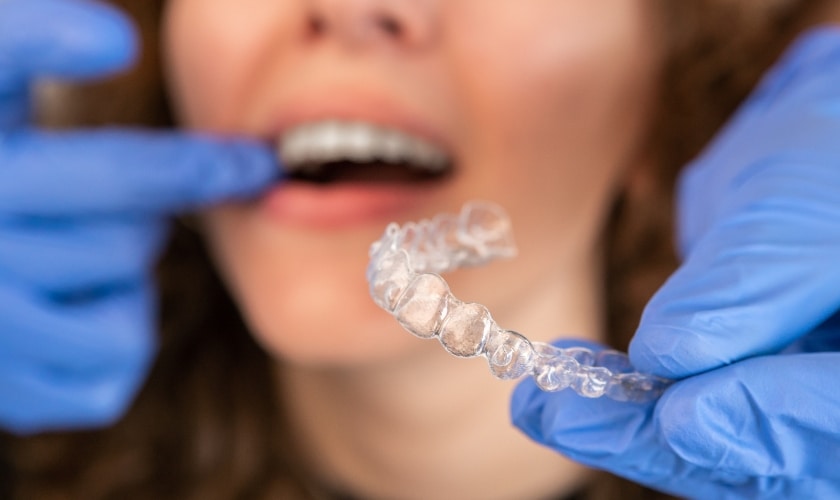 Maximizing Invisalign Comfort: Eating and Drinking Dos and Don'ts